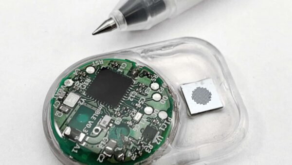 Smarte Implantater: Fremtidens Sundhedspleje - MEDNOTE