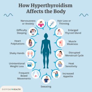 Hyperthyreose: Symptomer, Årsager og Behandling - MEDNOTE