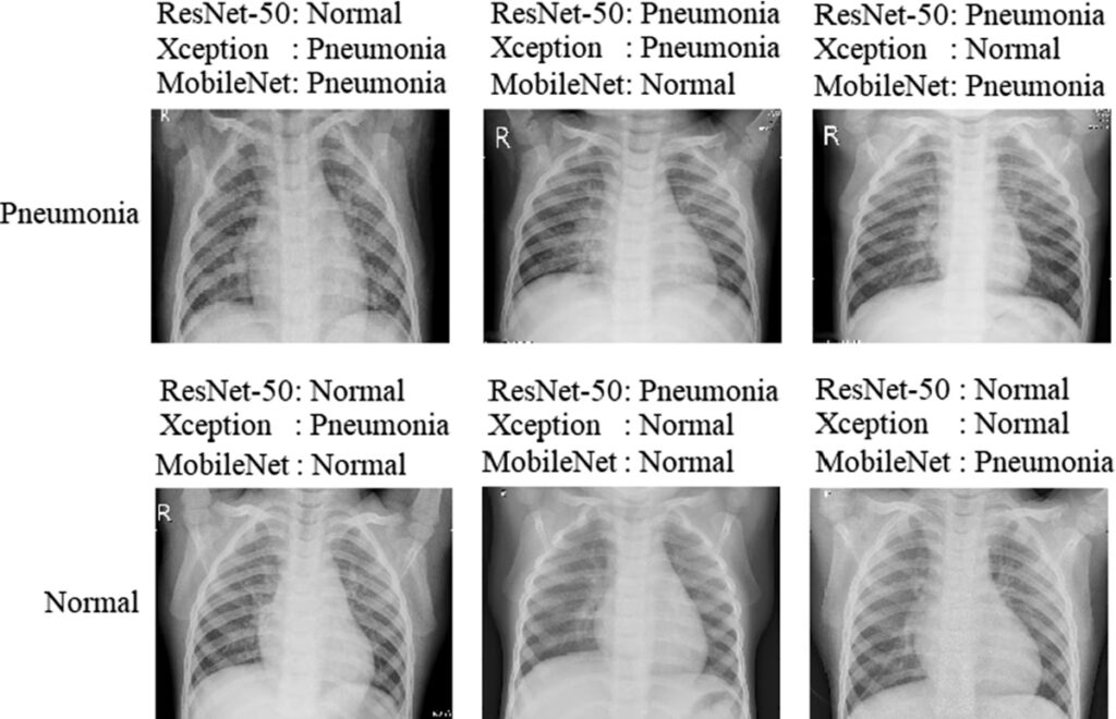 Røntgen ved Børnelungebetændelse: Nødvendigt? - MEDNOTE