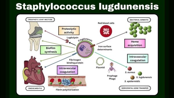 Guide til Staphylococcus lugdunensis Infektion - MEDNOTE
