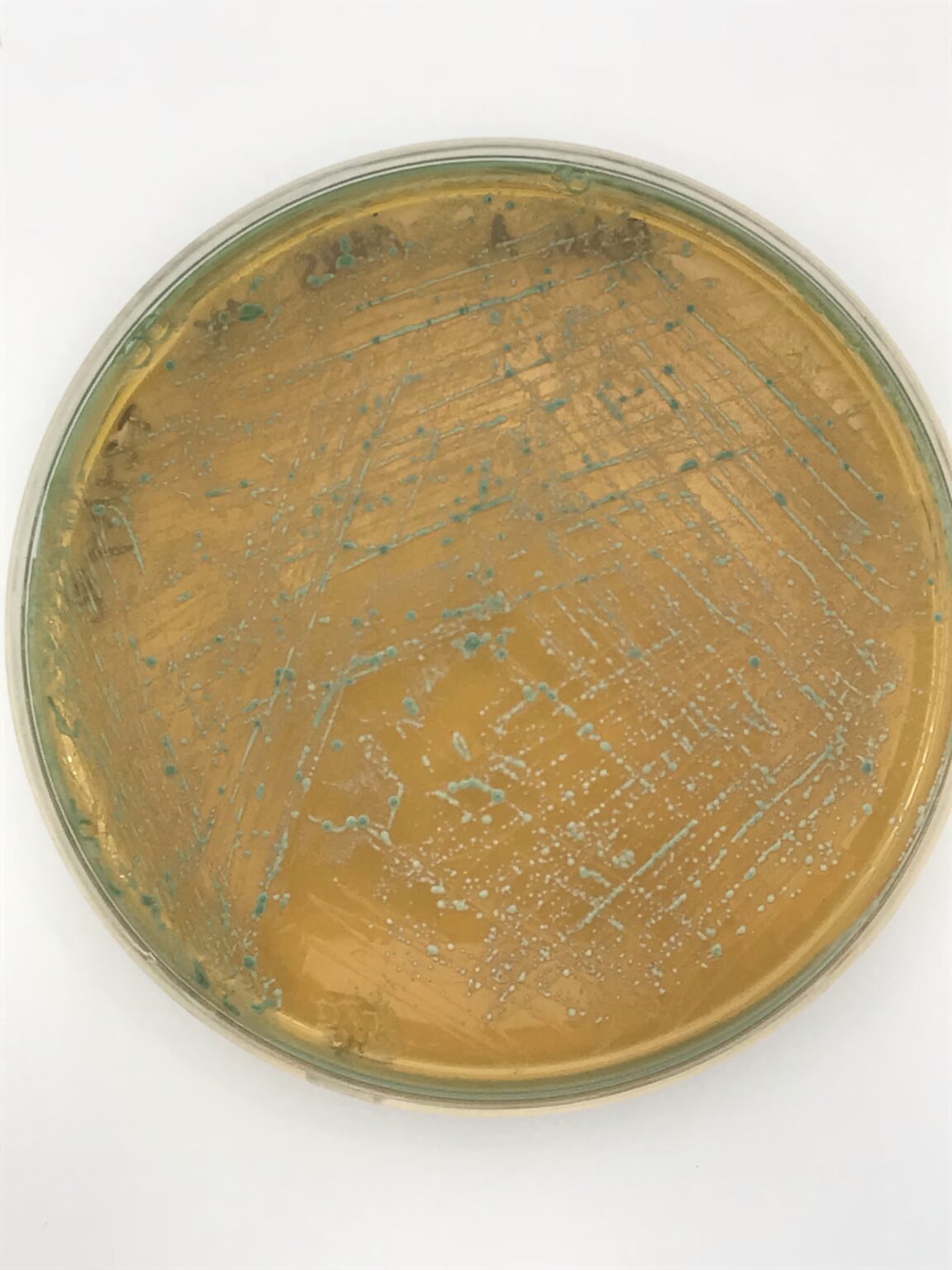 Streptococcus Thermophilus Agar: En Dybdegående Guide - MEDNOTE