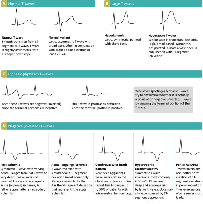 T-tak Inversion i Afledning III: Er det Normalt? - MEDNOTE