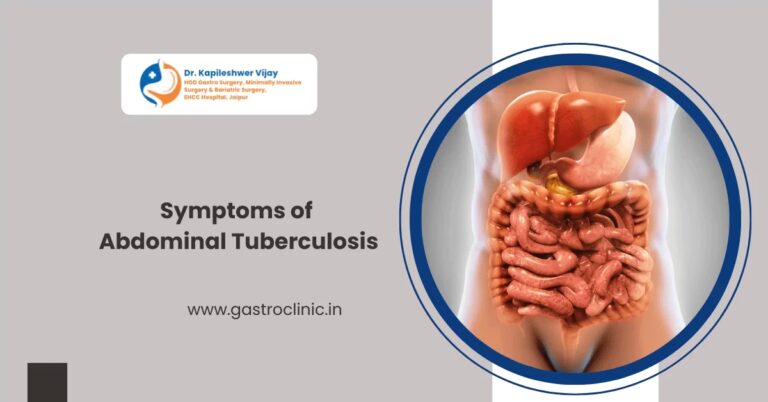 Gastrointestinal Tuberkulose: En Skjult Fjende - MEDNOTE