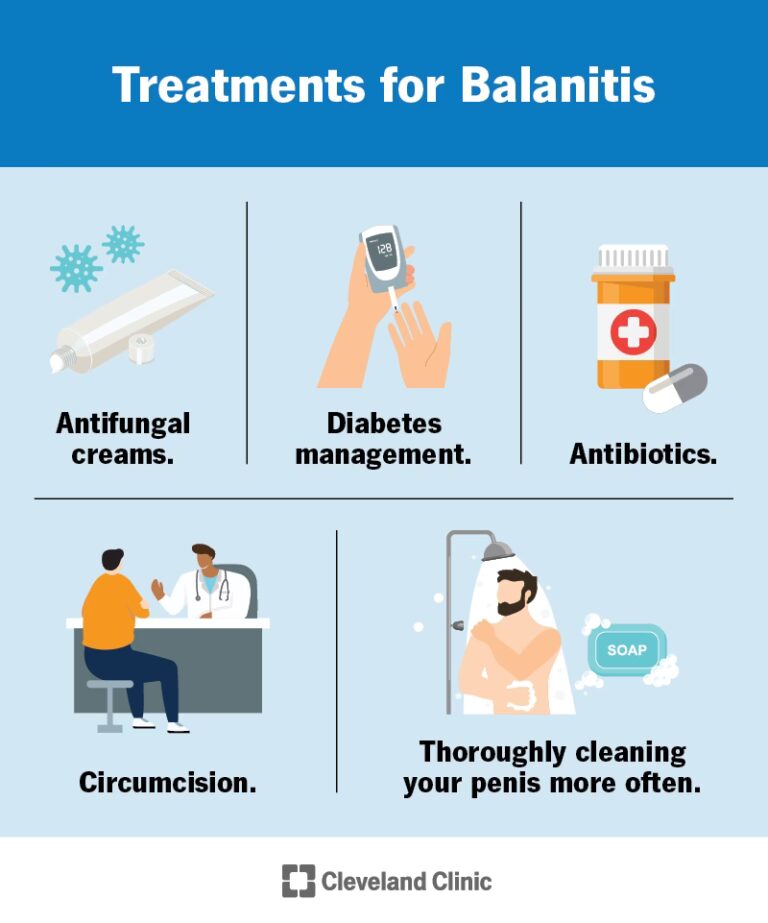 Balanitis: Guide til Symptomer og Behandling - MEDNOTE